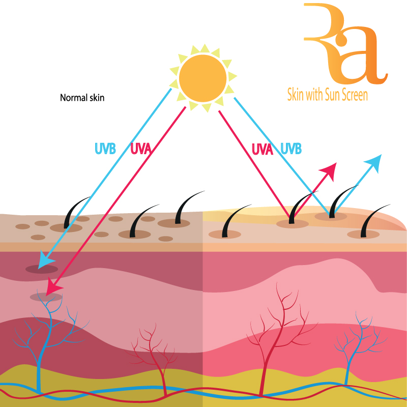 Summer Intense Sun: How to Protect Yourself? - Dr. Rashmi Shetty