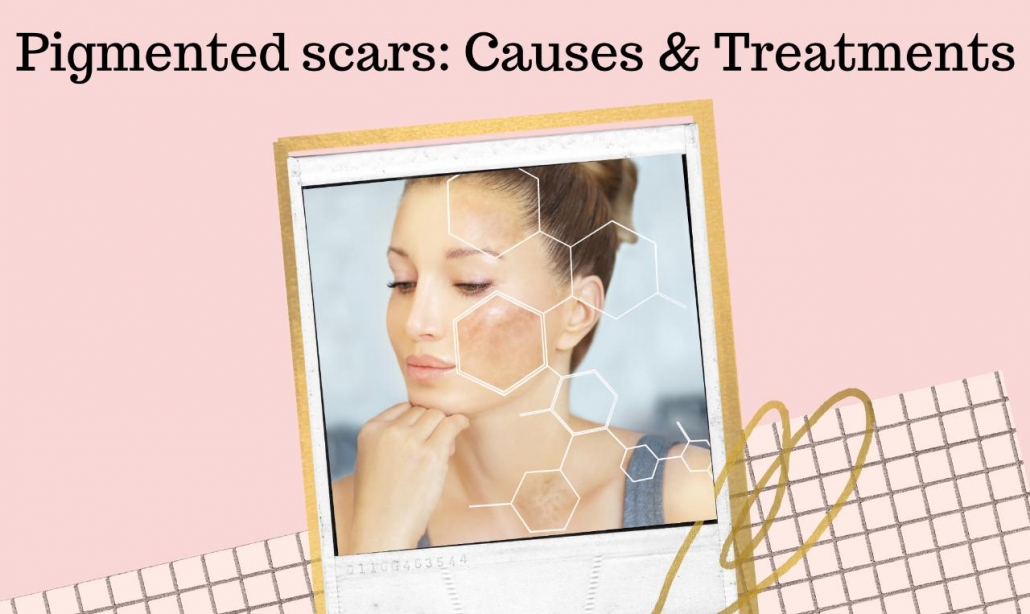 Pigmented scars: Causes & Treatments - Dr. Rashmi Shetty